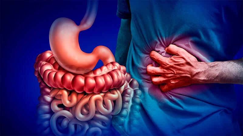 Doença de Crohn: Entenda a condição inflamatória crônica que impacta o ...